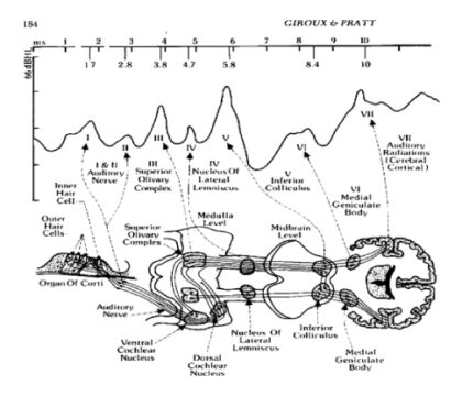 Bera Hearing Test | Bera Test For Hearing | Bera Test For Adults | Bera ...